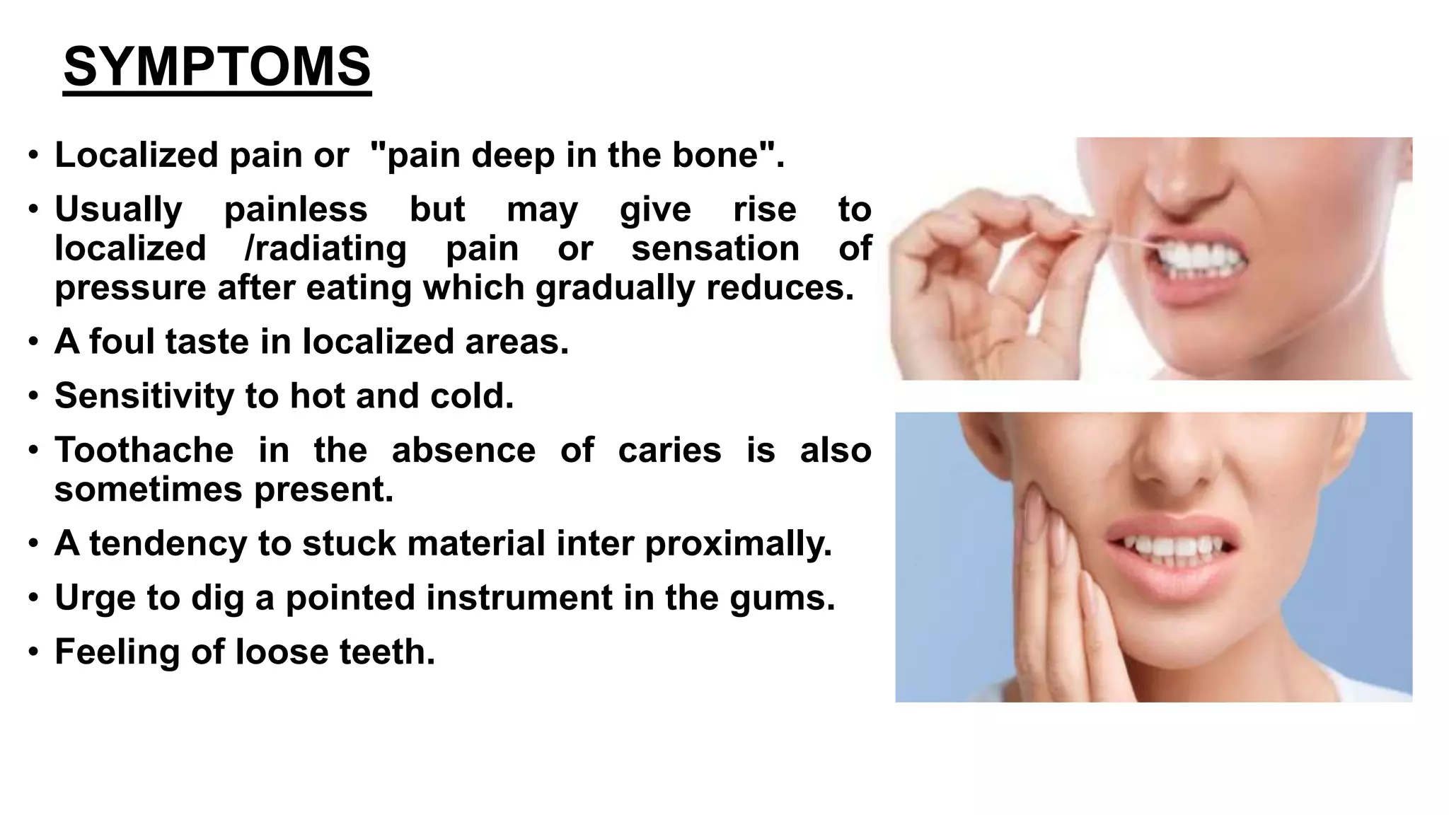 Periodontal pocket | PPTX