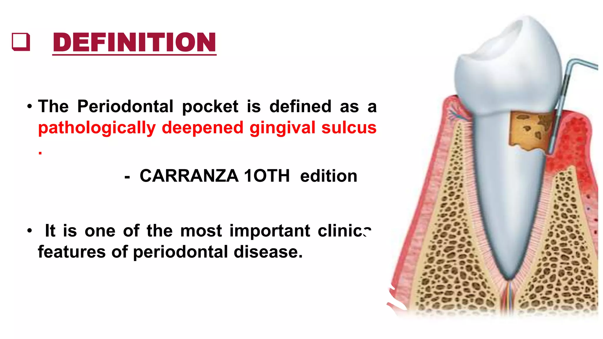 Periodontal pocket | PPTX