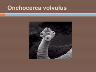 Onchocerca volvulus | PPTX