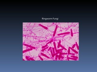 Ringworm Under Microscope