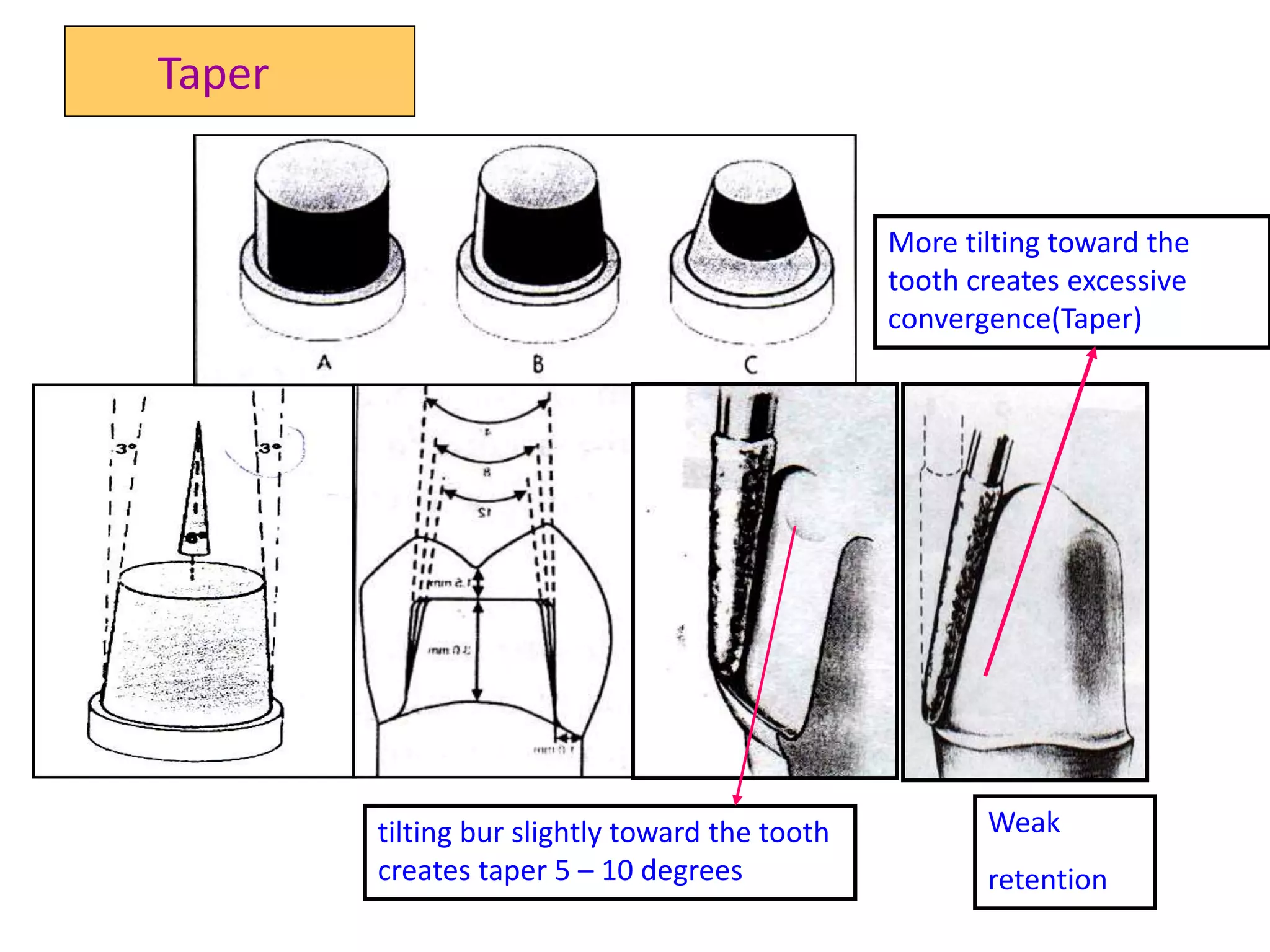 crown lec1- principles of tooth preparation(v.good) | PPTX
