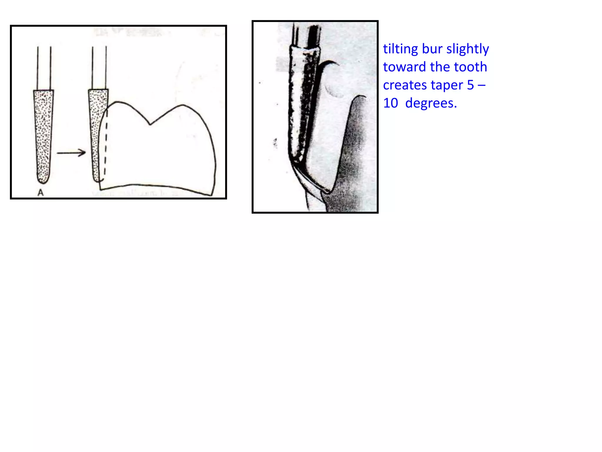 crown lec1- principles of tooth preparation(v.good) | PPTX
