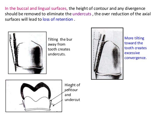 crown lec1- principles of tooth preparation(v.good)