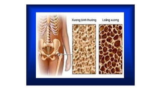 NGUYÊN TẮC SỬ DỤNG CORTICOID | PPT