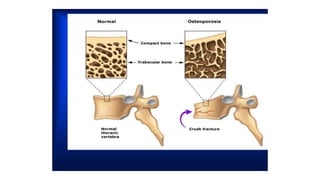 NGUYÊN TẮC SỬ DỤNG CORTICOID | PPT