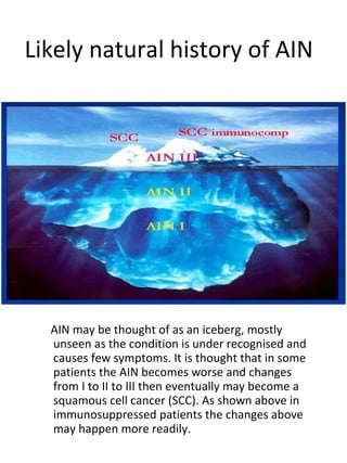 AIN | PPT