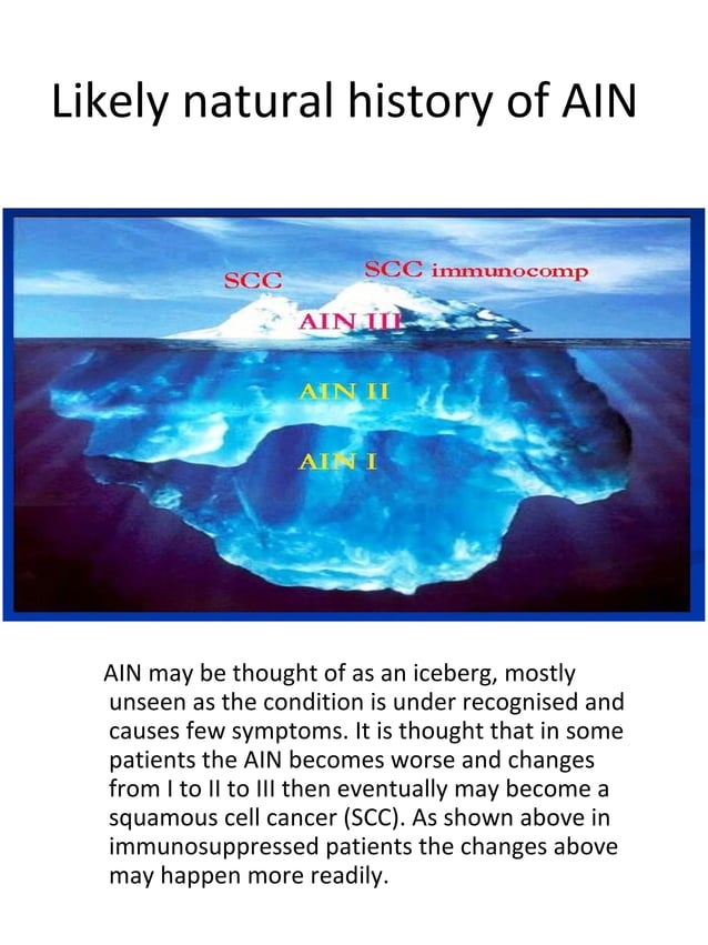 AIN | PDF