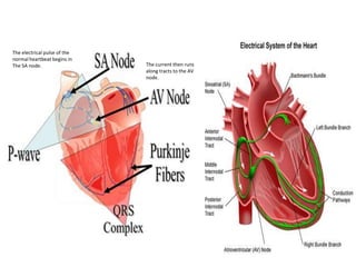 Electrical Conduction | PPTX | Heart and Cardiovascular Diseases | Diseases and Conditions