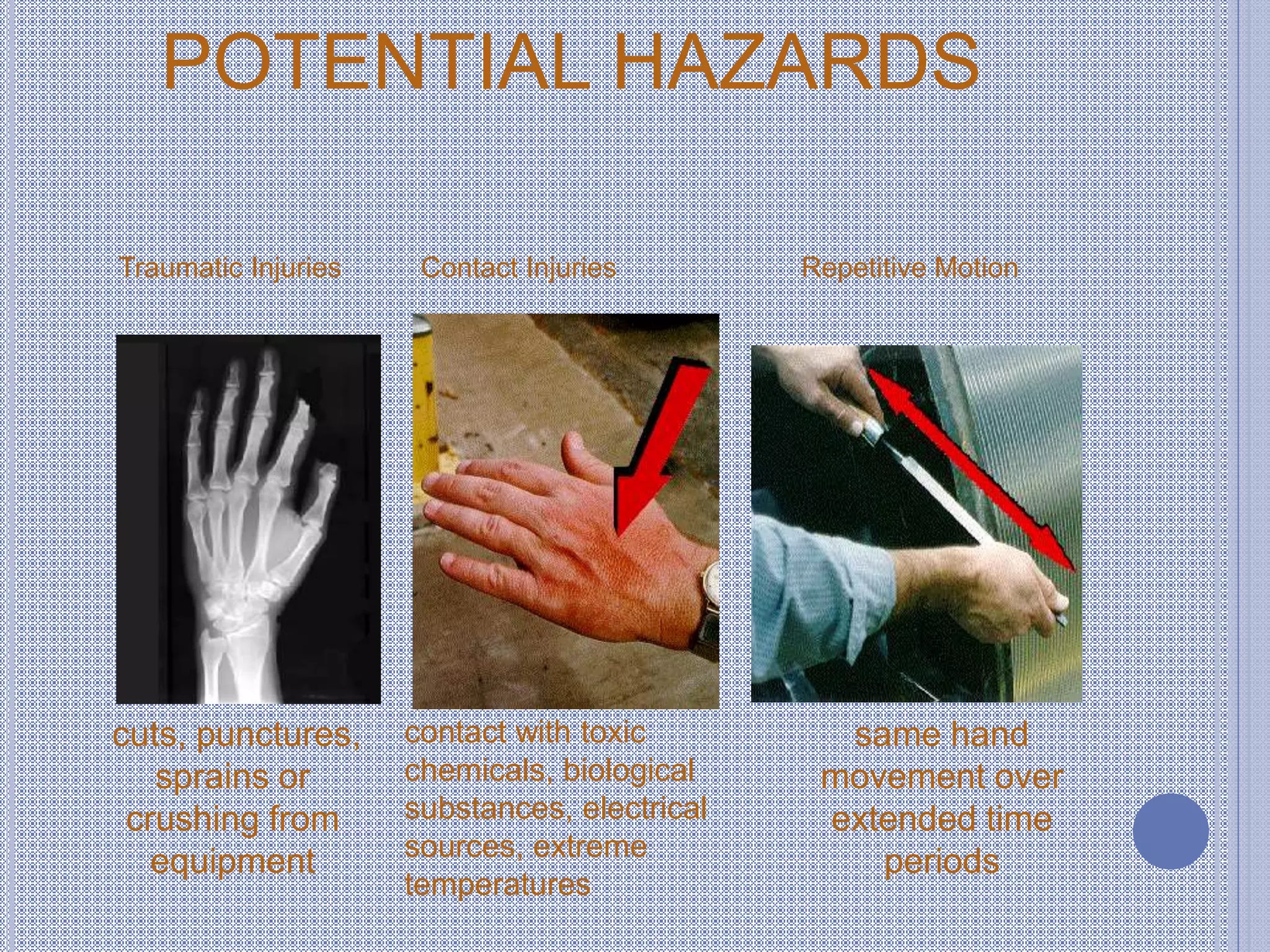 PPE( personal Protective equipment) | PPTX