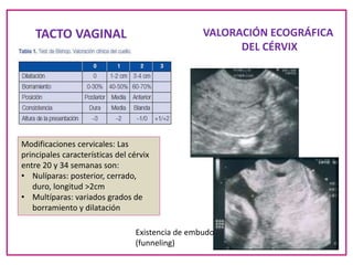 Parto prematuro | PPTX