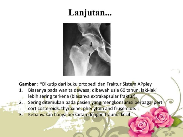 Ppt. fraktur collum femur | PPTX