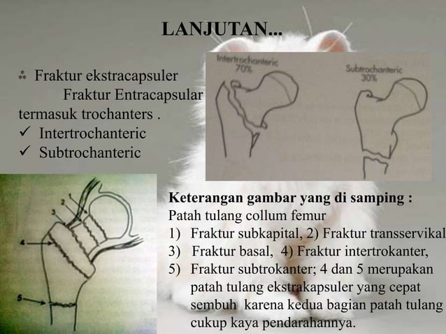 Ppt. fraktur collum femur | PPTX