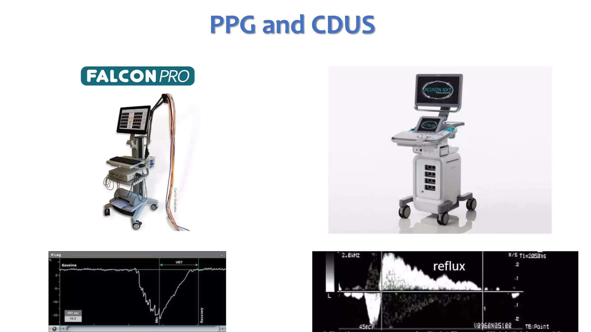 PPG and CDUS in venous reflux disease | PPTX