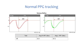 PPG and CDUS in venous reflux disease | PPTX