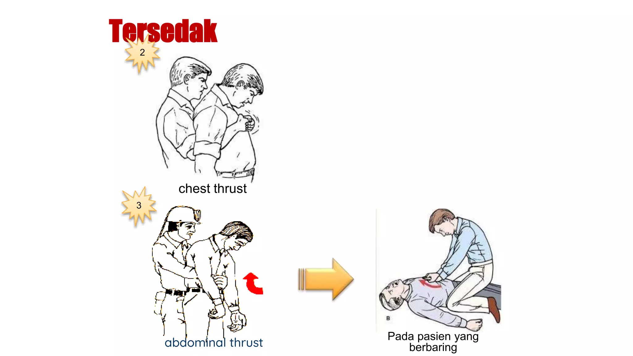 Pertolongan Pertama Gawat Darurat | PPTX
