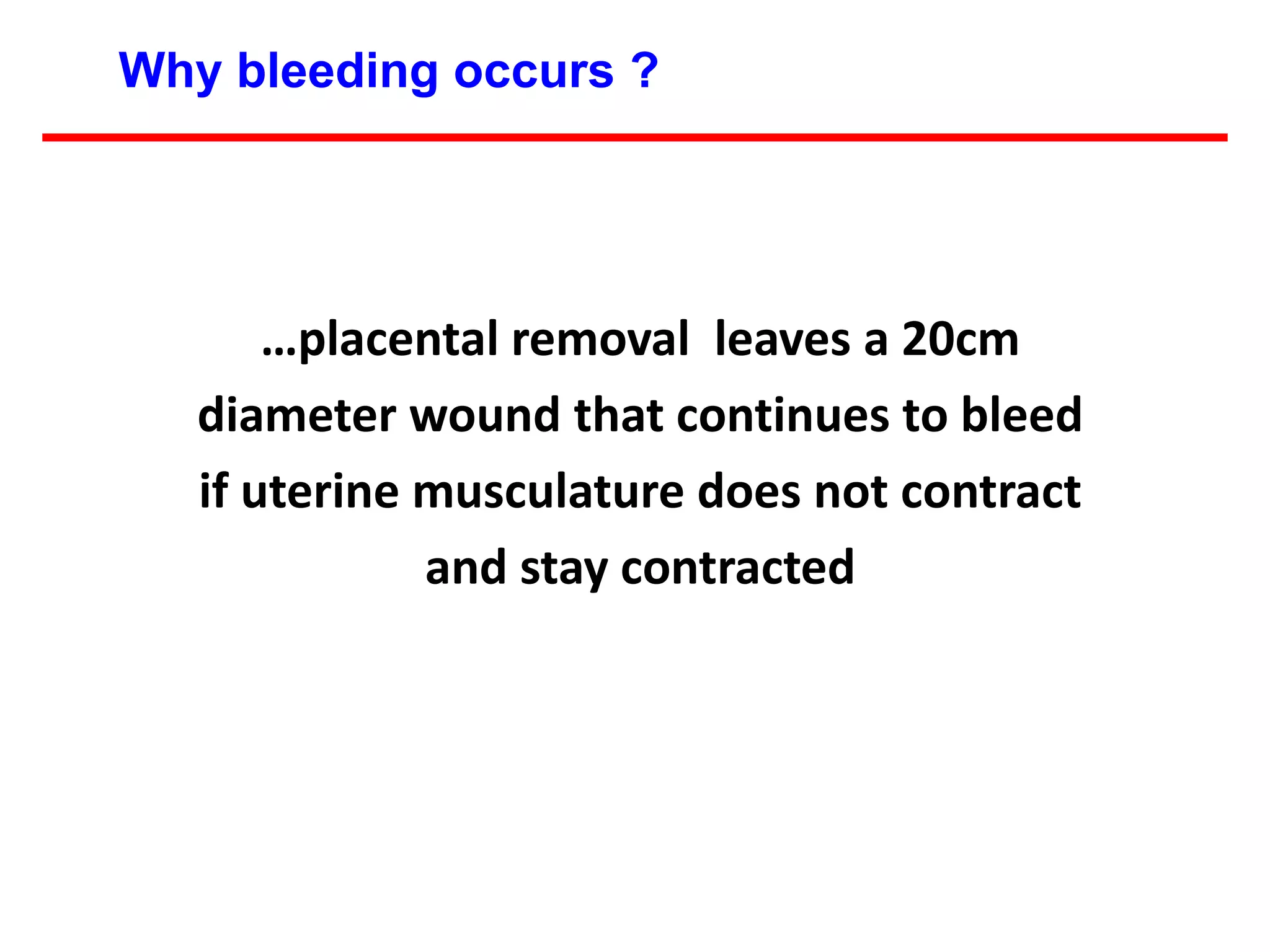 Medical Management of Post-partum Hemorrhage (PPH) | PPTX