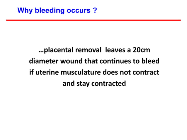 Medical Management of Post-partum Hemorrhage (PPH) | PPTX