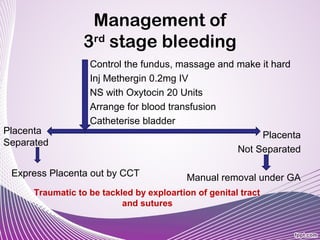 Post Partum Hemorrhage in ED | PPT