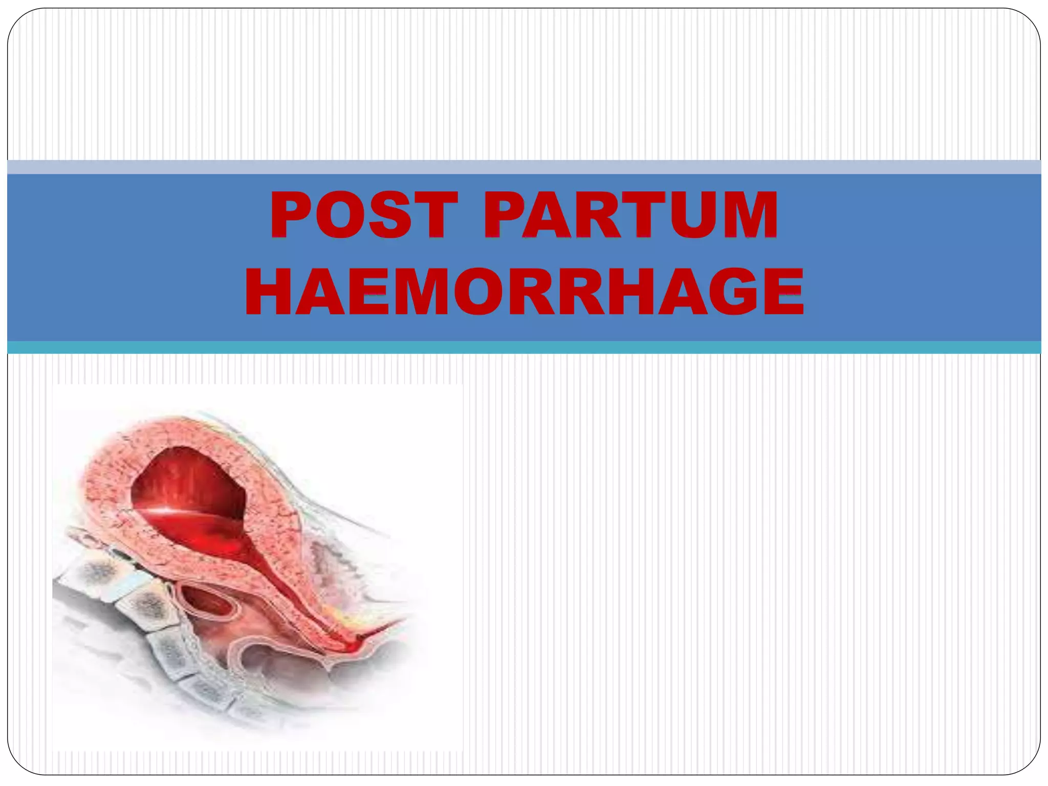 POST PARTUM HEMORRHAGE(PPH) | PPTX
