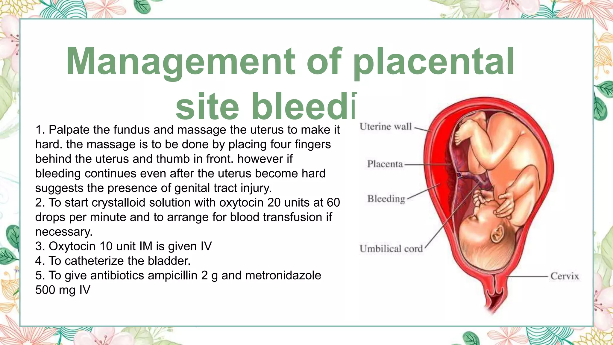 Nursing Management of Postpartum Haemorrhage by Devanshi | PPTX