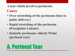 POST PARTUM HEMORRHAGE PPH POST PERTUM DELIVERY | PPTX