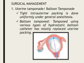PPH pppppppppppppppppppppppppppppppp.pptx | Pregnancy | Reproductive Health