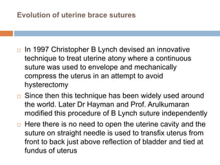 KỸ THUẬT B LYNCH | PDF