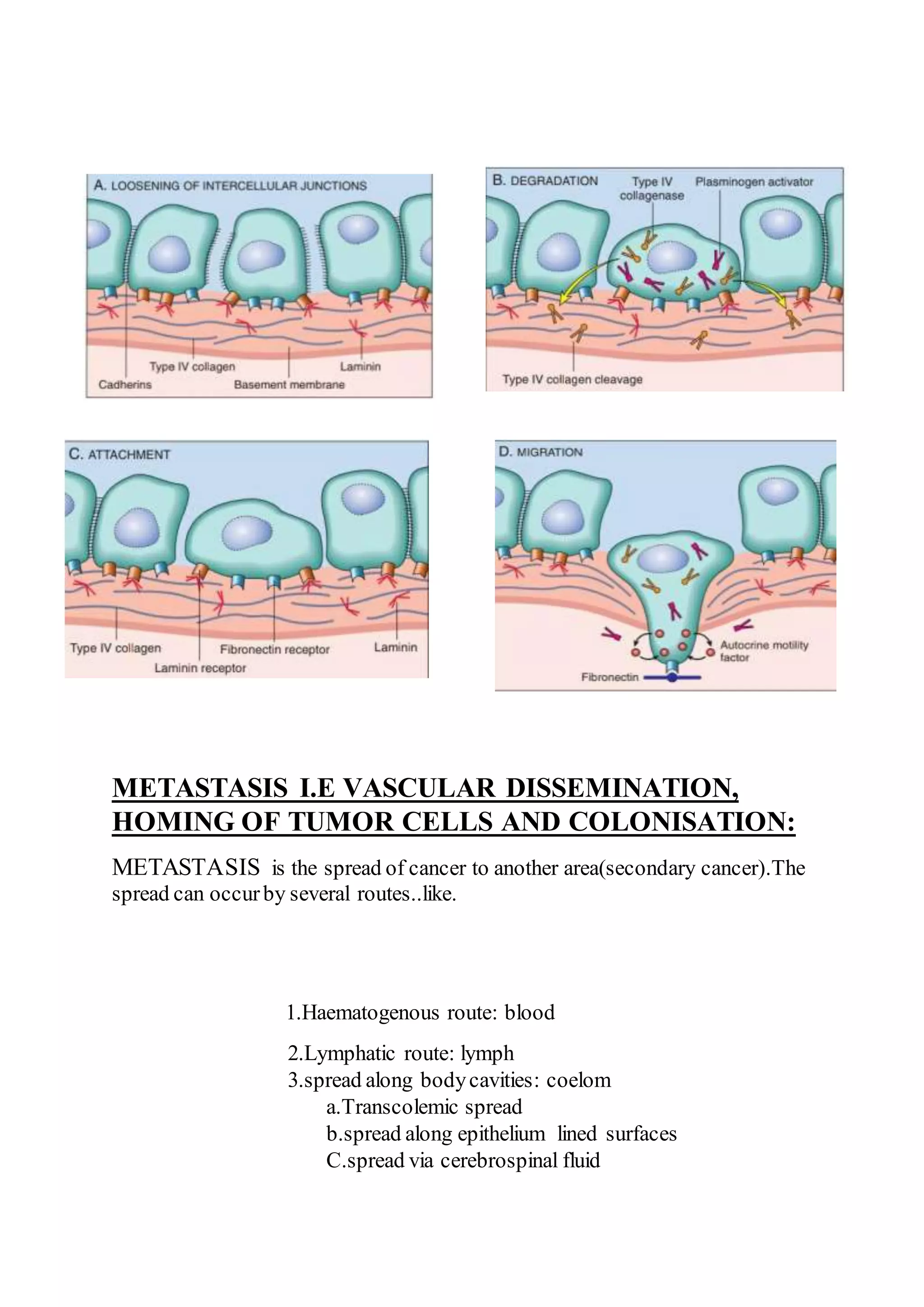 cancer invasion and metastasis | DOCX