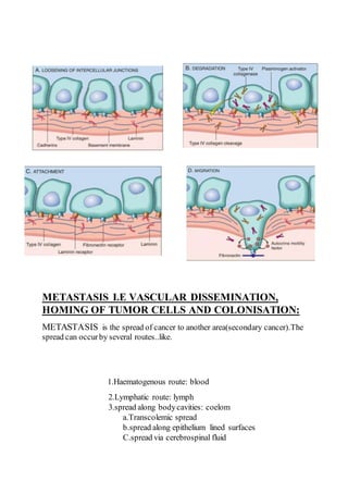cancer invasion and metastasis | PDF