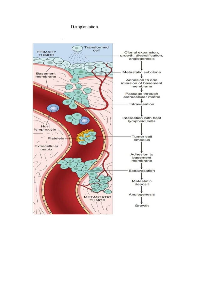 cancer invasion and metastasis | PDF