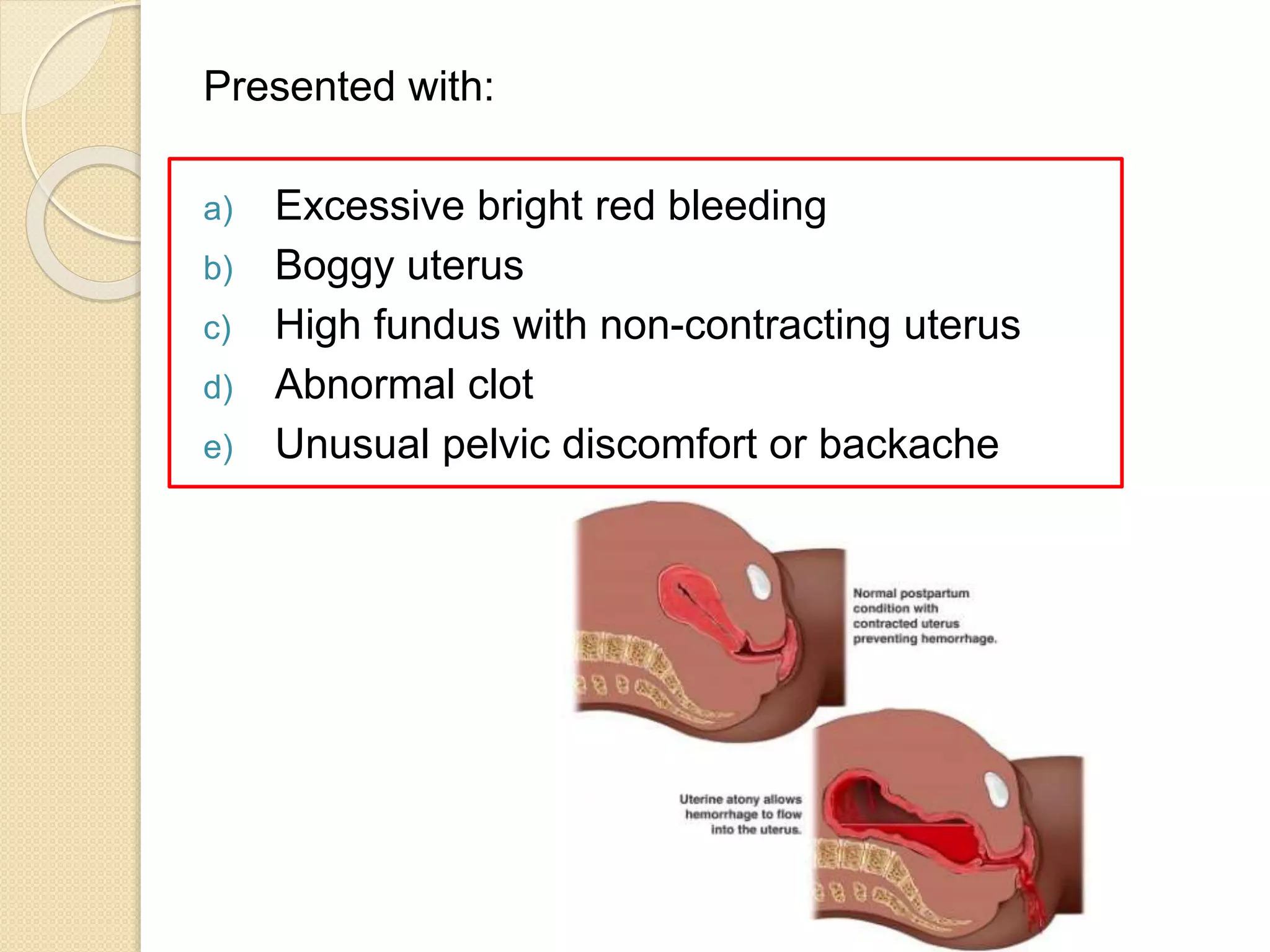 post partum haemorrhage | PPTX