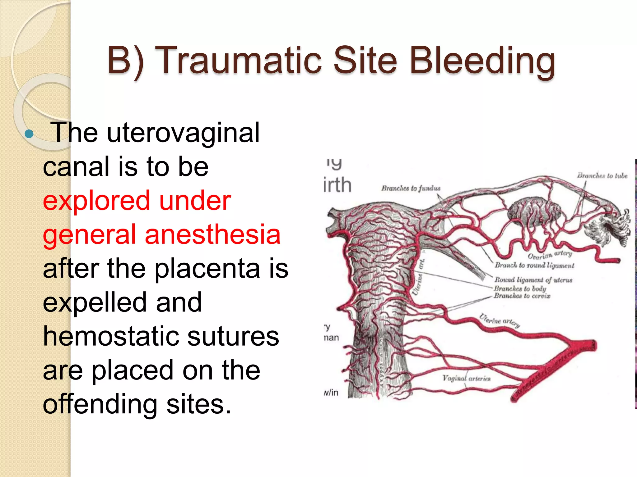post partum haemorrhage | PPTX