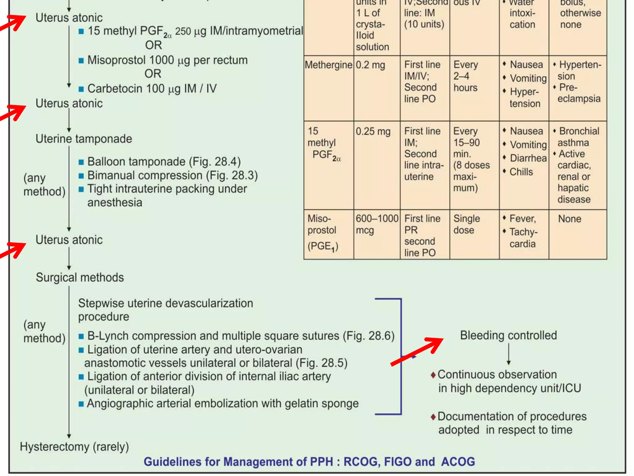 post partum haemorrhage | PPTX