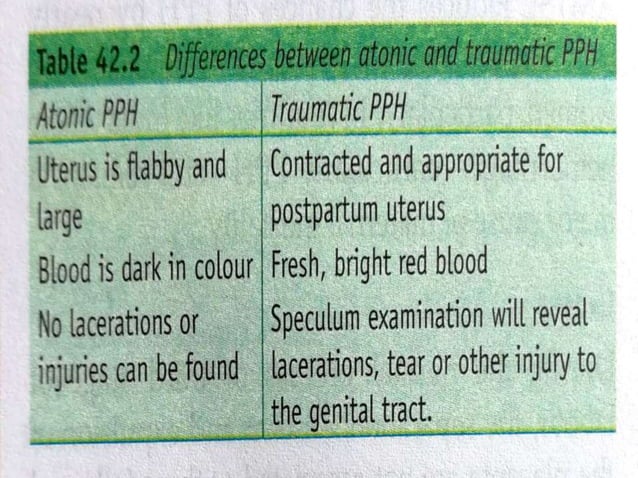post partum haemorrhage | PPTX