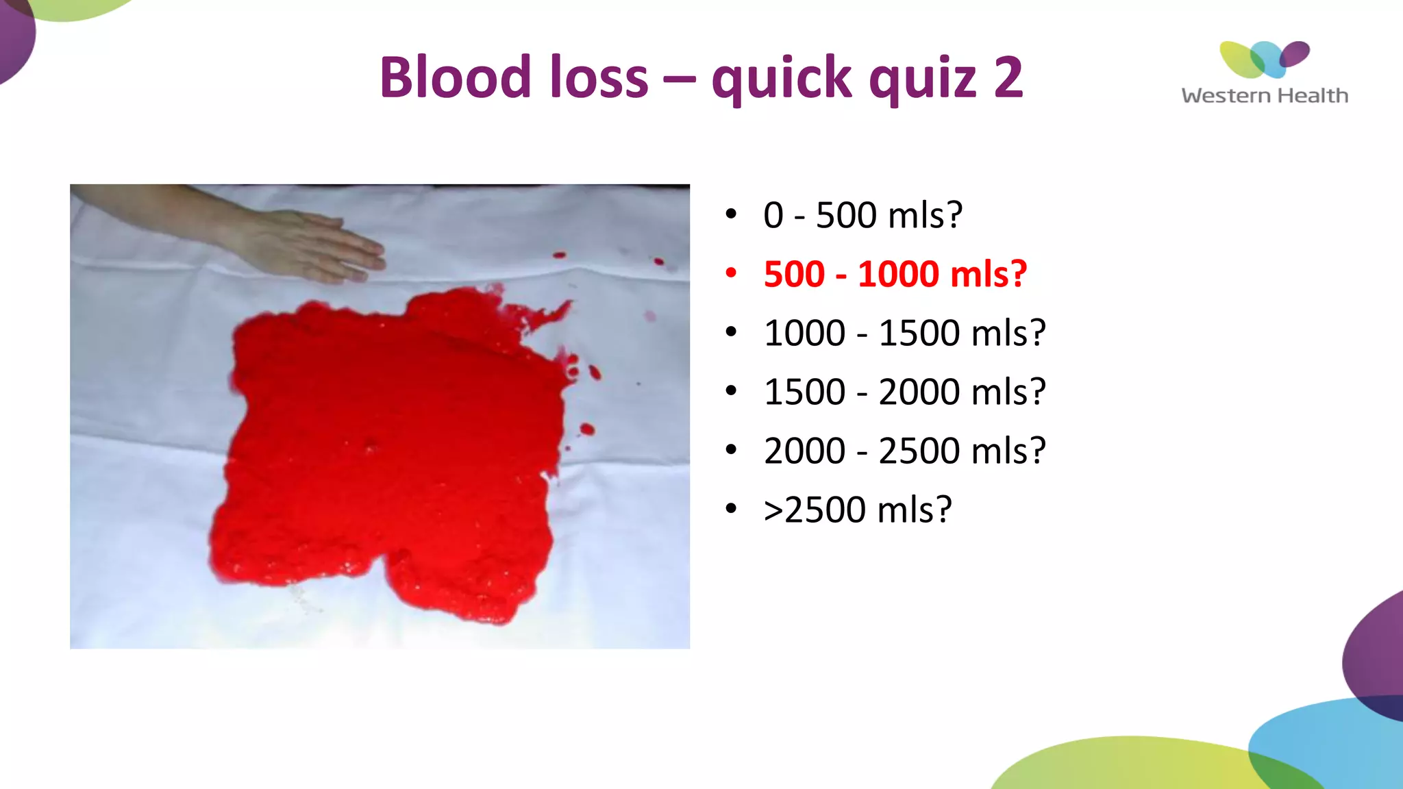 OBSTETRIC PPH DRILL | PPTX