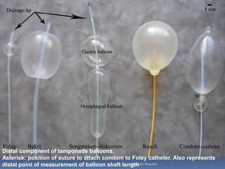 Baloon tamponade in management of postpartum haemorrhage | PDF