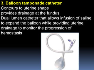 Baloon tamponade in management of postpartum haemorrhage | PDF