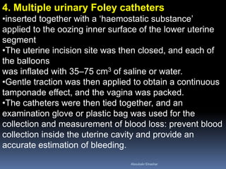 Baloon tamponade in management of postpartum haemorrhage | PDF