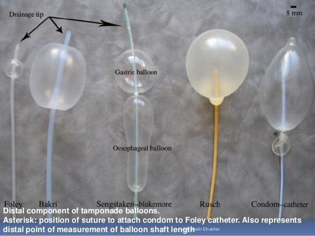 Baloon tamponade in management of postpartum haemorrhage