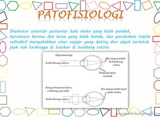 power point hipermetropi | PPTX