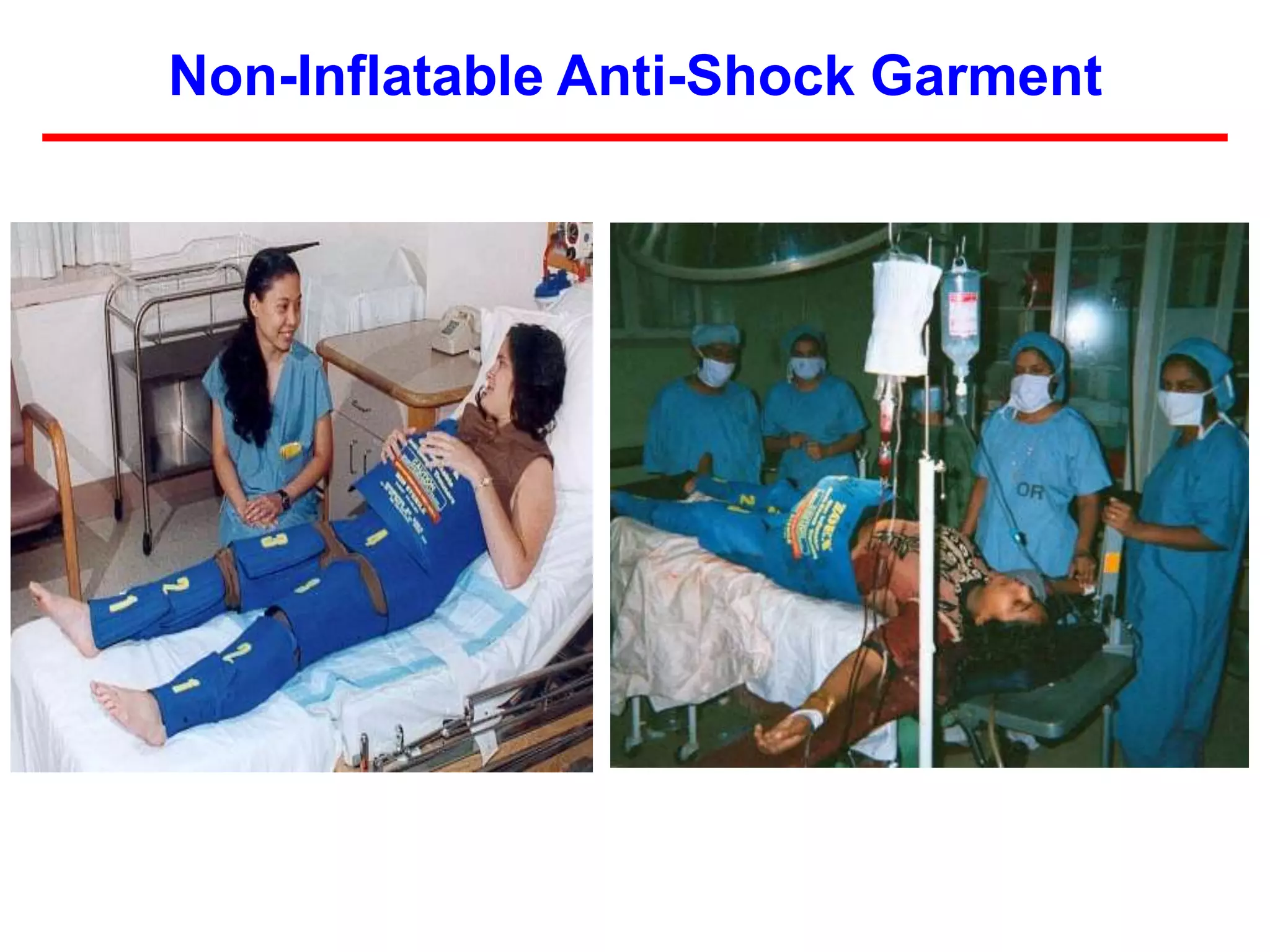 Management of Post-partum hemorrhage (PPH) | PPTX