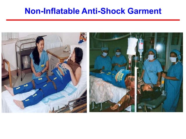 Management of Post-partum hemorrhage (PPH) | PPTX