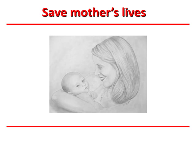 Management of Post-partum hemorrhage (PPH) | PPTX