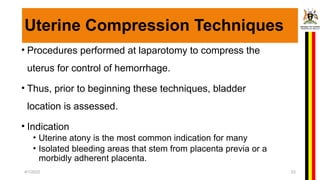 Postpartum Hemorrhage_Management_presenation[2].pptx