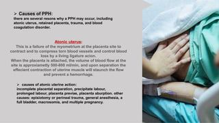 PPH maternity.Renad Manasrah.pptxhhhhhhhhhjjh | PPT