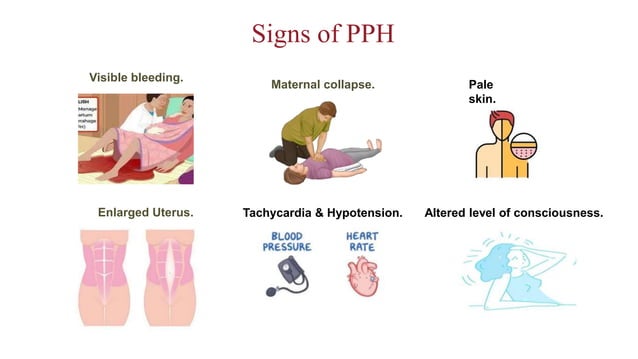 PPH maternity.Renad Manasrah.pptxhhhhhhhhhjjh | PPT
