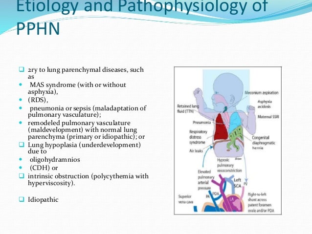 Persistent Pulmonary Hypertension Ati Template - prntbl ...