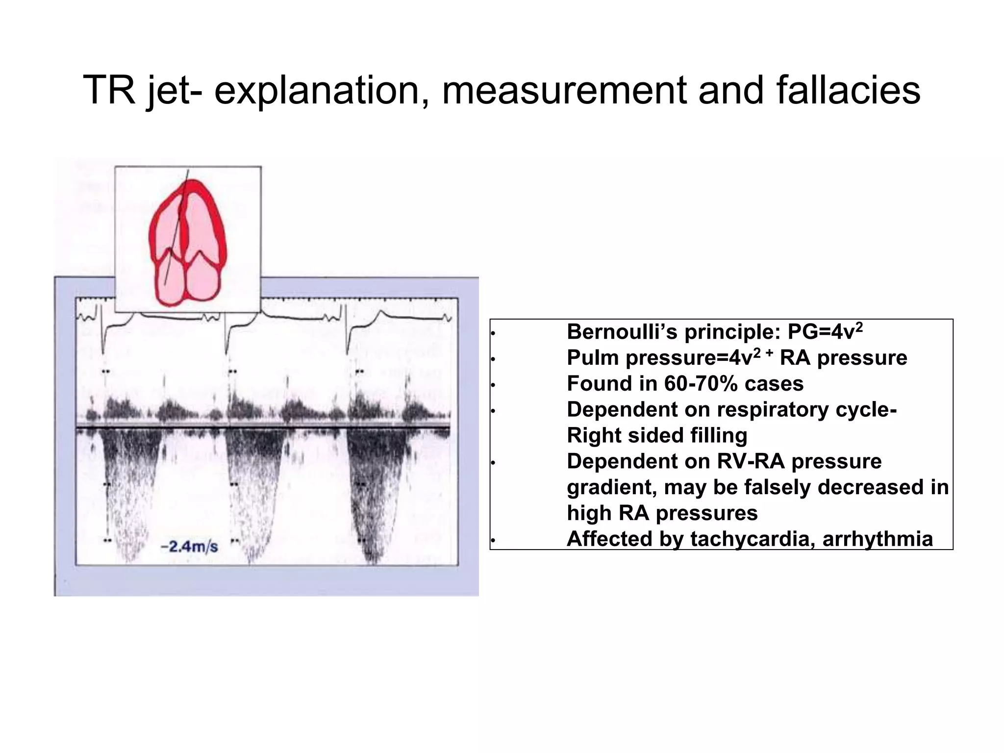 PPHN -pathophysiology and management | PPTX