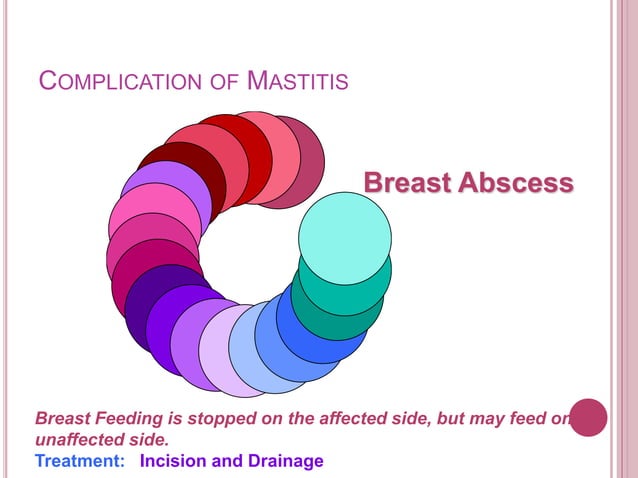 Post partum hemorrhage | PPT