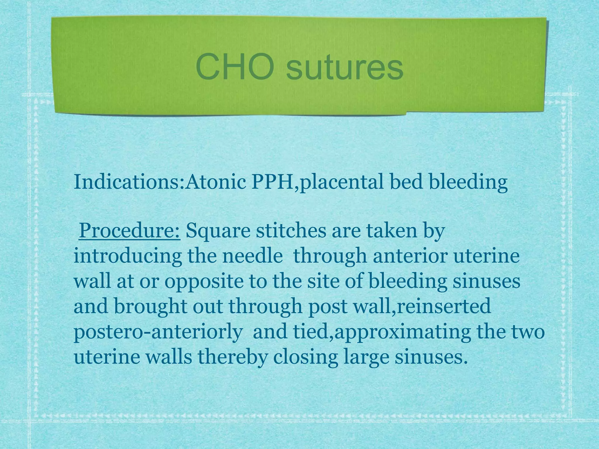 Surgical Management of Postpartum Hemorrhage | PPTX